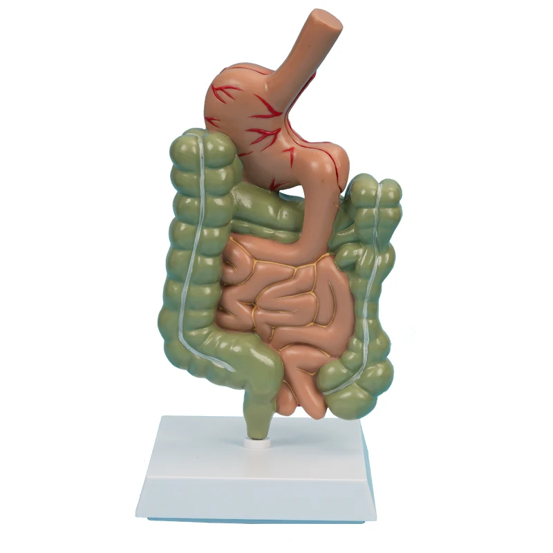 Maag Model Anatomie Gi Tract Model Zieke Spijsvertering Maag Anatomie