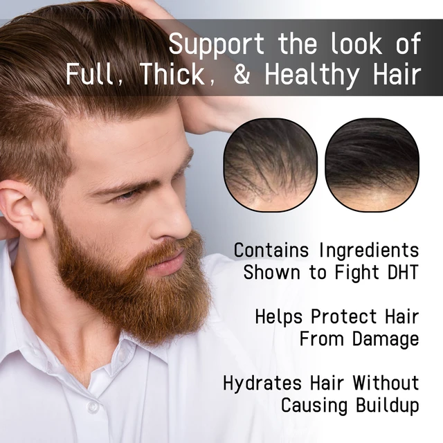 Spray On Hairline