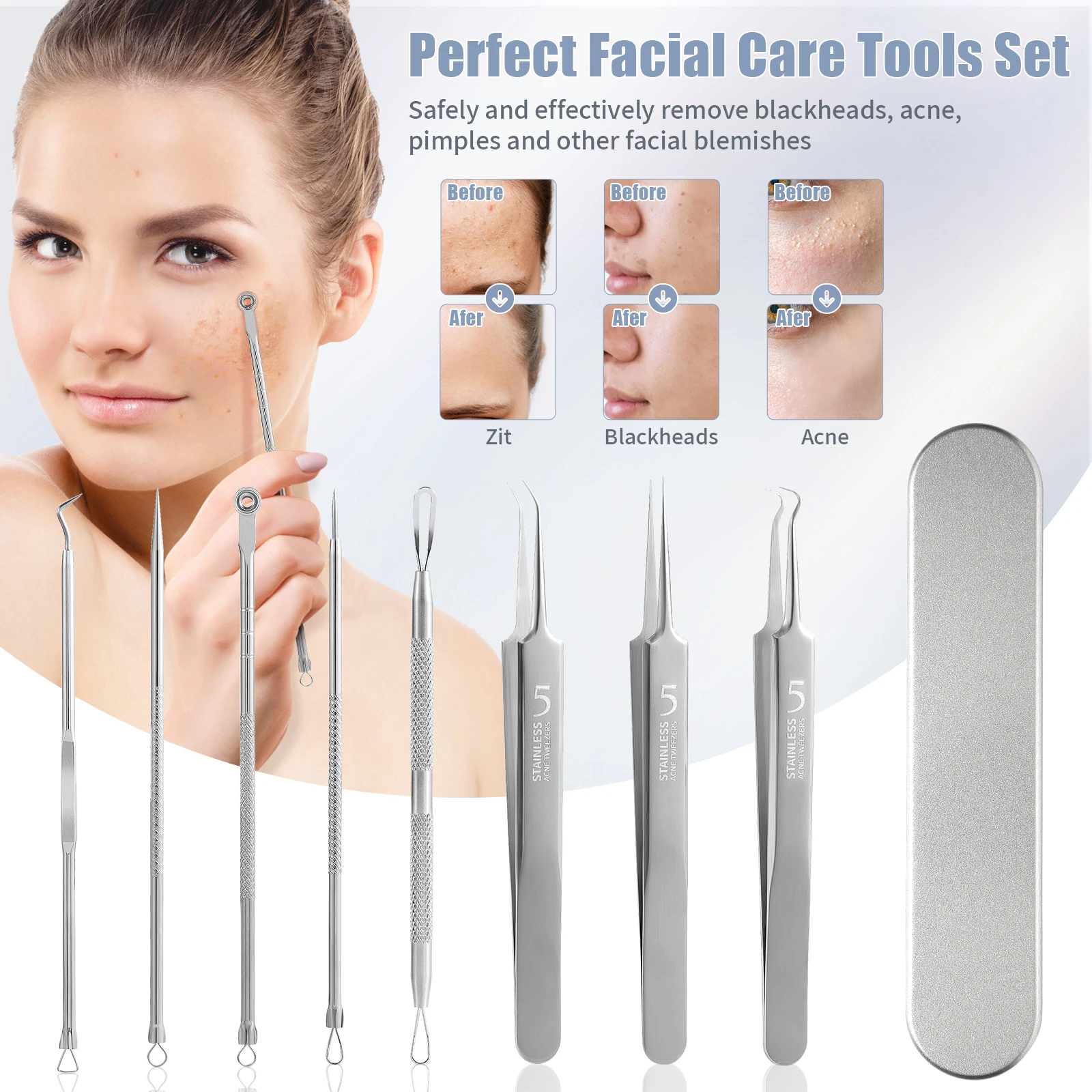 Top 5 Pimple Popping Tools for Effective Acne Removal: A Detailed ...