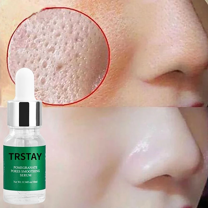 Pore Shrinking Serum Essence Pores Treatment Moisturizing Relieve ...