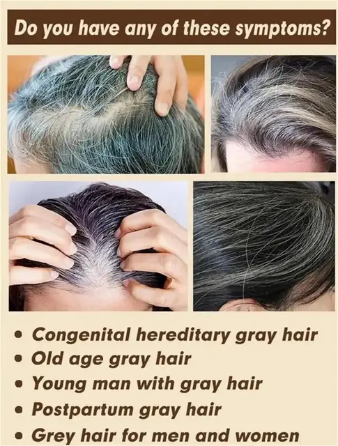 Cure gray recognized hair turn gray