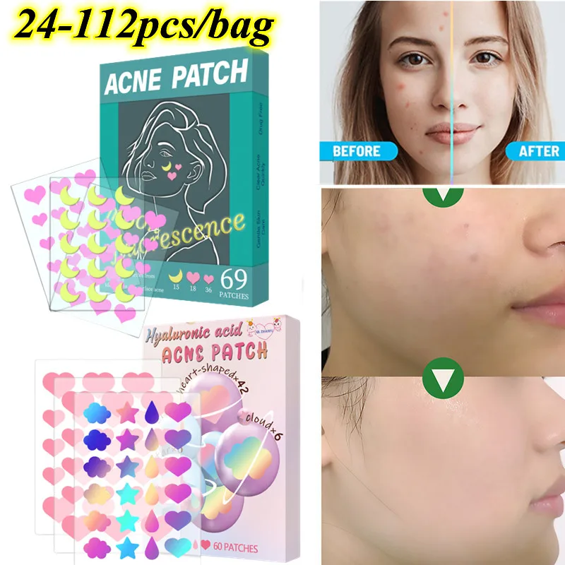 24-112pcs-bag-Anti-ance-Patch-Hydrocolloid-Acne-Pimple-Removal-Sticker ...