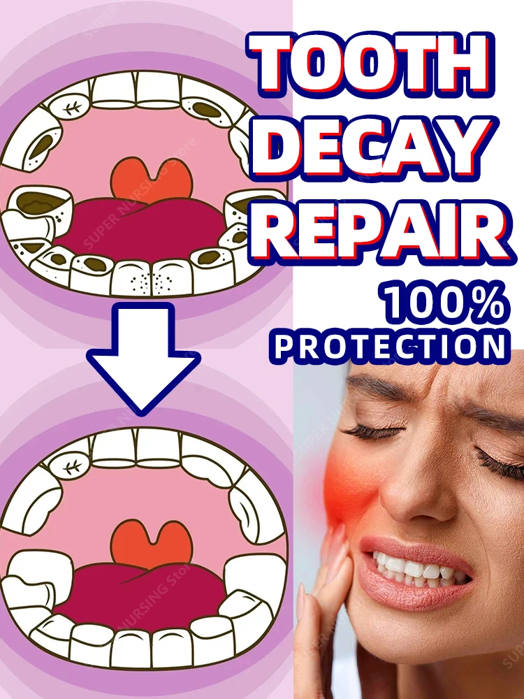 Tooth-decay-repair-Repair-all-tooth-decay-cavities-and-protect-teeth.jpg