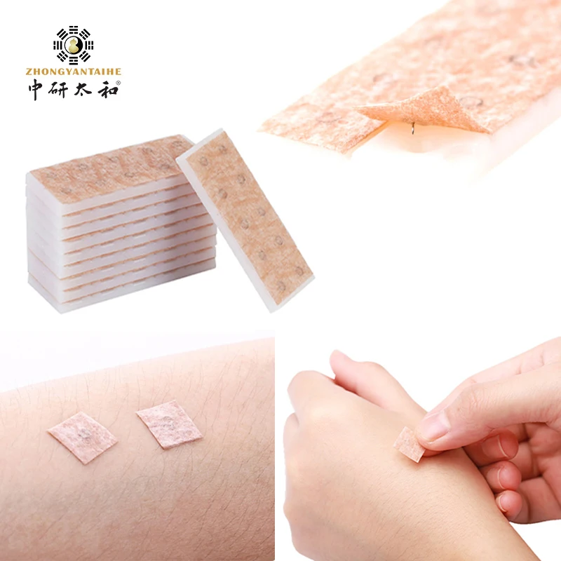 ZHONGYAN-100Pcs-Ear-Acupuncture-Needle-Disposable-Press-Needle-for-Ear ...