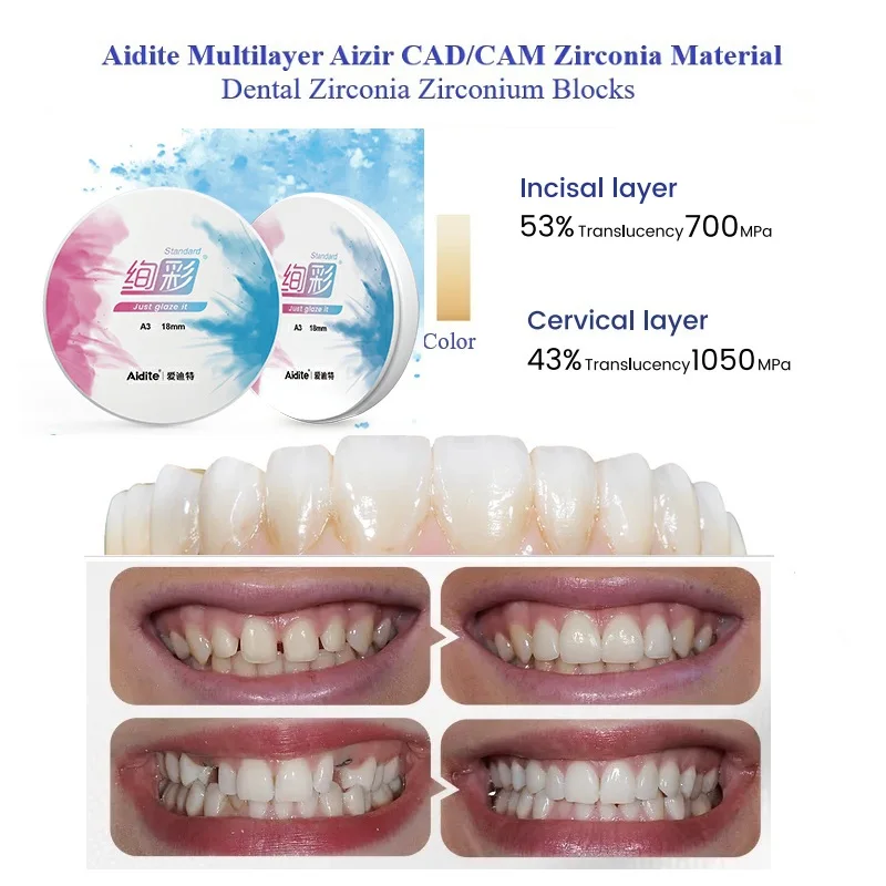 Aesthetic-16Colors-Dental-Zirconia-Zirconium-Blocks-Aidite-AiZir ...