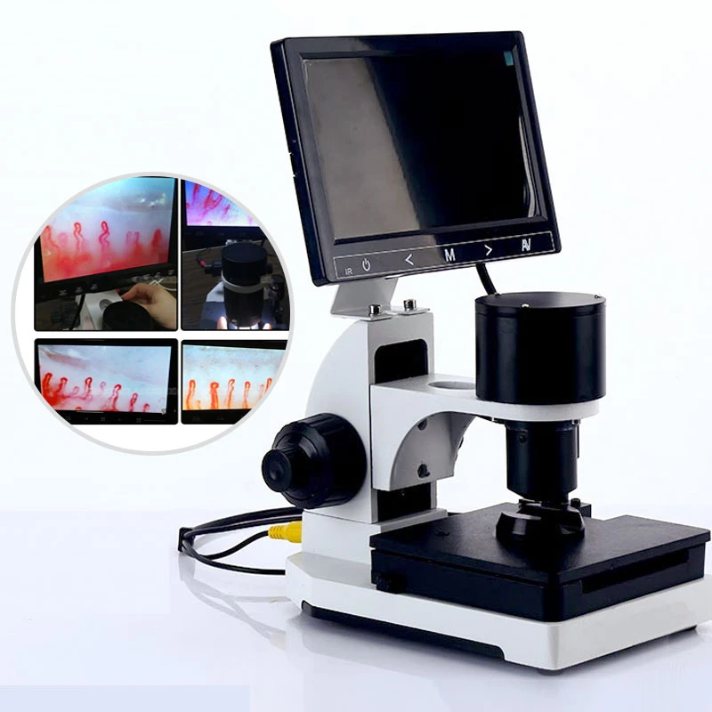 Nailfold Capillary Microcirculation Detector Digital Microscope Blood ...