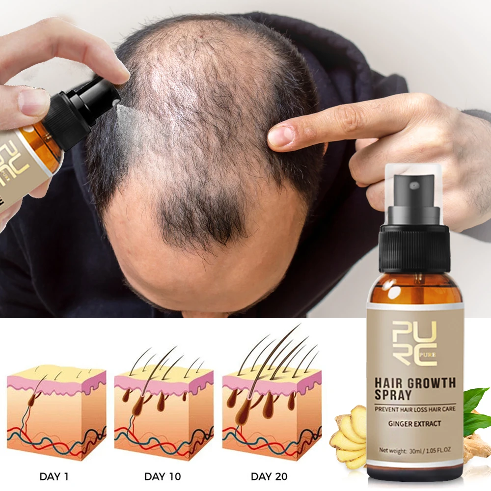 Fast-Hair-Growth-Spray-Products-Scalp-Skin-Care-Anti-Hair-Loss-Serum ...