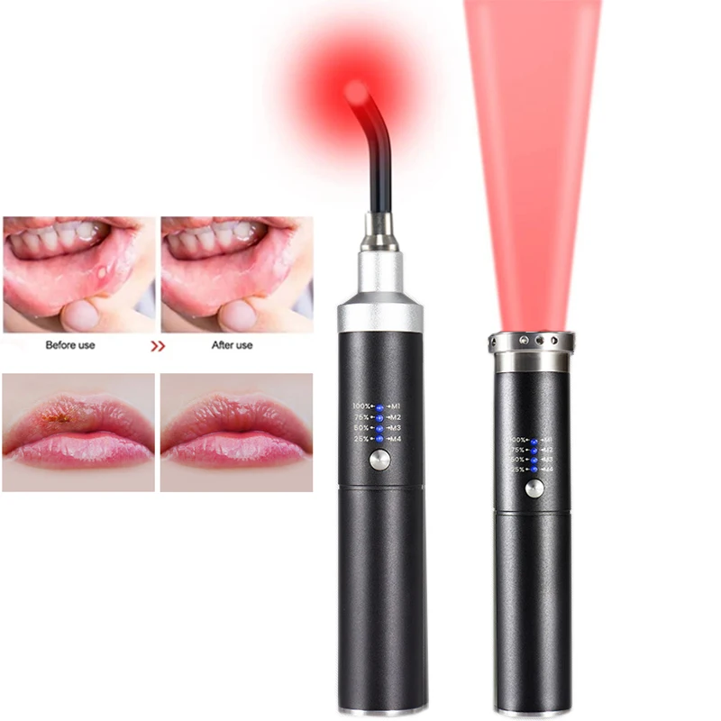 Professional-Red-Light-Infrared-Therapy-Device-Sore-Canker-Lip-Handheld ...