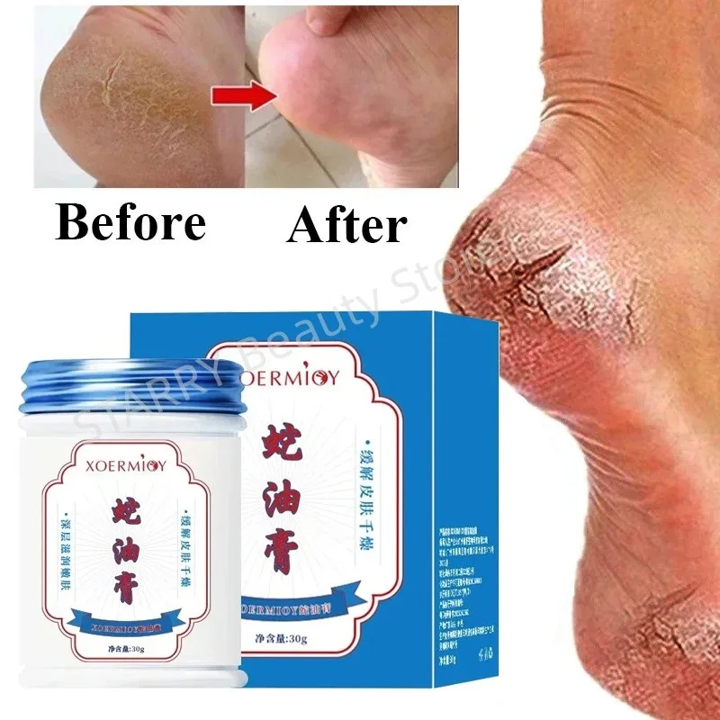 Herbal-Anti-Crack-Foot-Cream-Heel-Cracking-Repair-Products-Exfoliation ...
