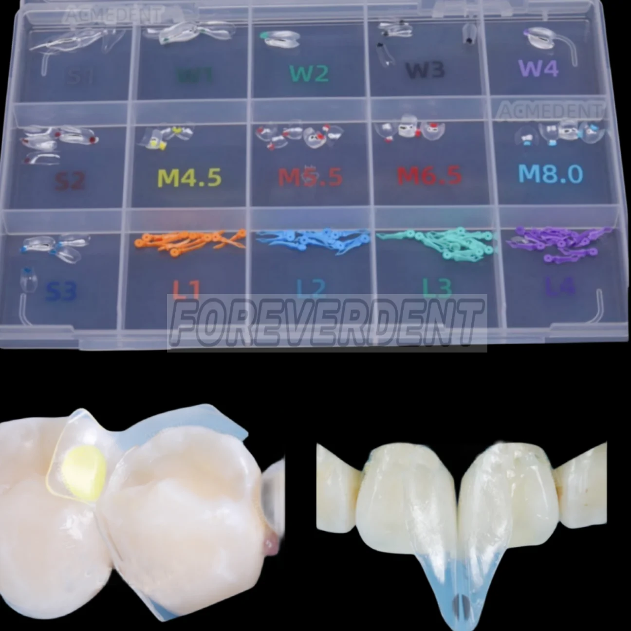 1Box-Dental-Clear-Matrix-BT-Matrices-Black-Triangle-Wedges-Diastema-Fits-BioClear.png