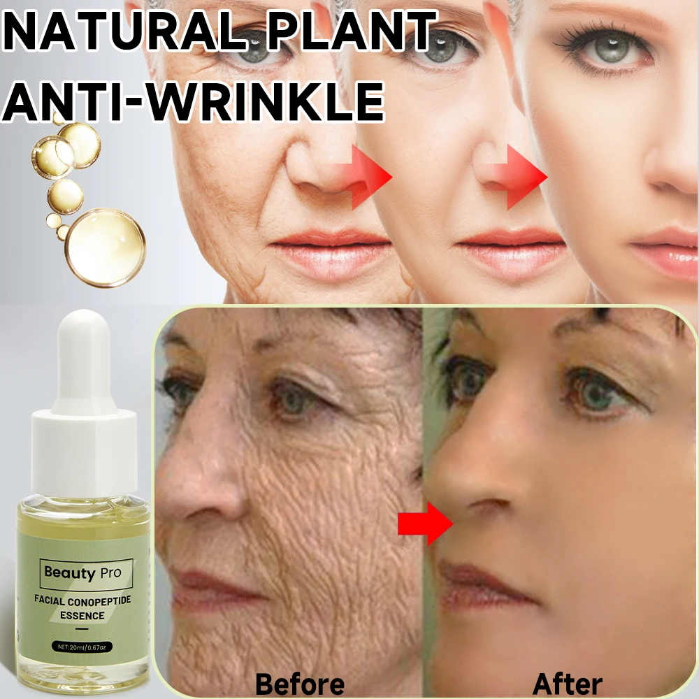 Anti-Wrinkle-Essence-Permanently-Removes-Wrinkles-Fine-Lines-Forehead ...