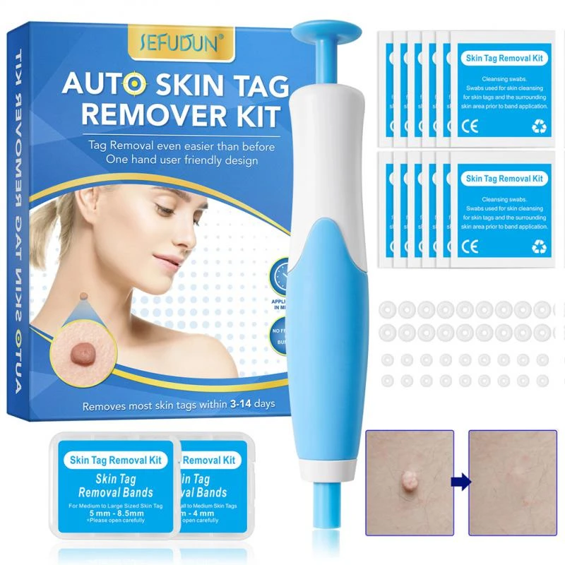 2 In1 Painless Auto Skin Tag Mole Wart Removal Kit Beauty Health Face ...