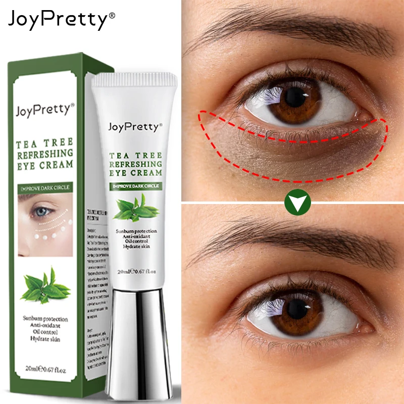 Joypretty Anti Dark Circle Eye Cream Anti Wrinkle Remove Eye Bags ...