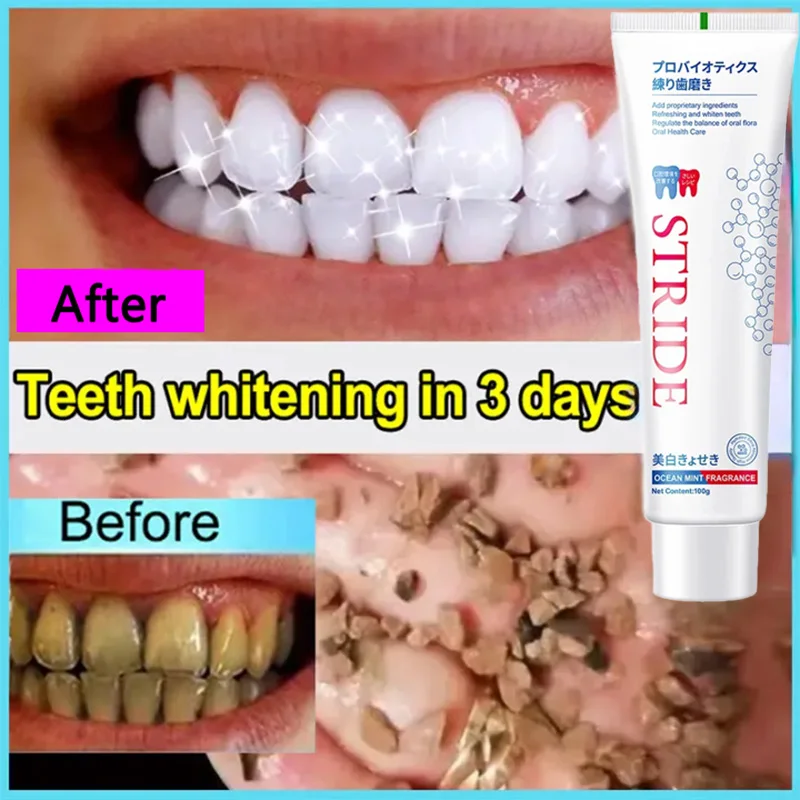 Dental-Calculus-Remover-Toothpaste-Whitening-Teeth-Brightening ...