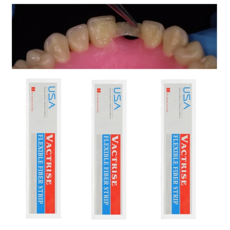 3Pcs-Dental-Material-Flexible-Fiber-Strip-Glass-Splint-Loose-Tooth ...