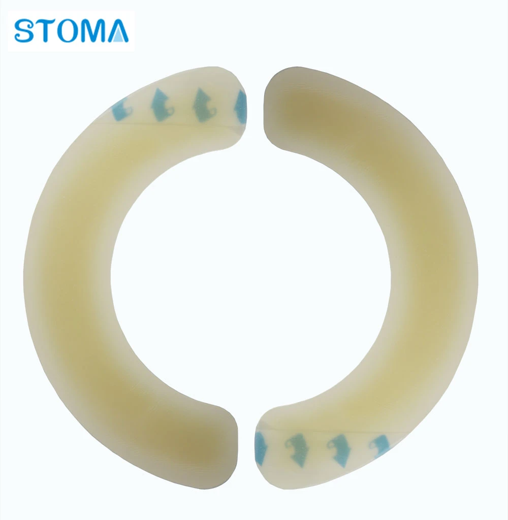 Ostomy Barrier Tape Elastic Strips Sensetive Skin Stoma Nursing ...