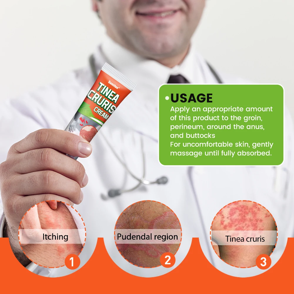 Tinea Cruris Treatment Cream