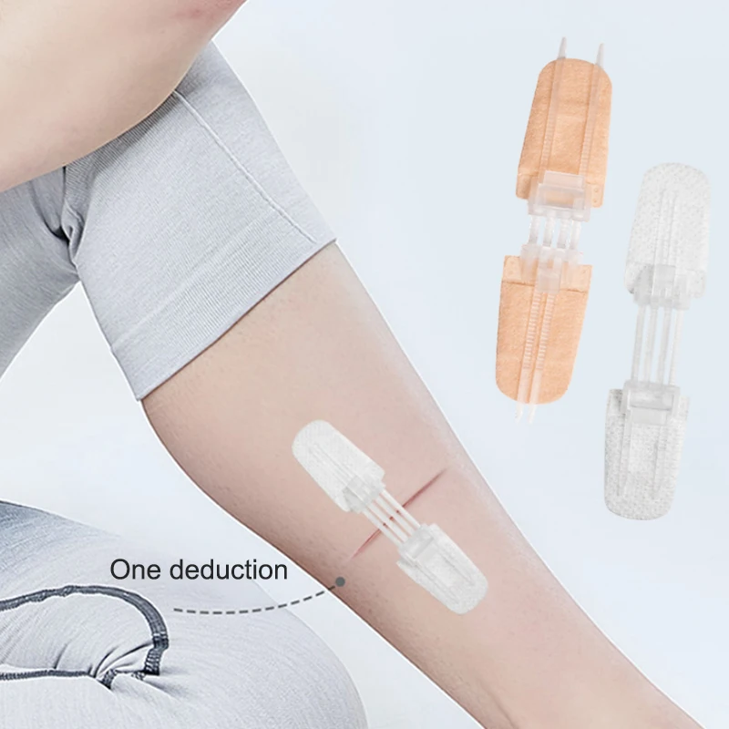 Zipper Band-aid Painless Wound Closure Patch Suture-free Wound Dressing ...