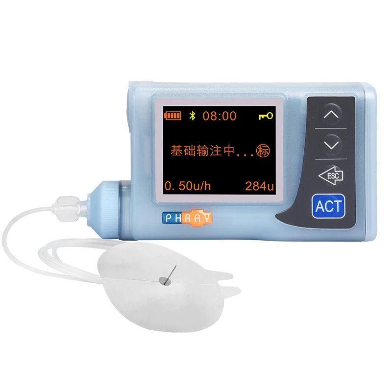 Pompa Per Infusione Ambulatoriale Esterna Di Insulina