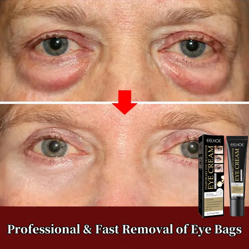 Cr-me-anti-d-formable-pour-les-yeux-limine-les-poches-sous-les-yeux-les ...