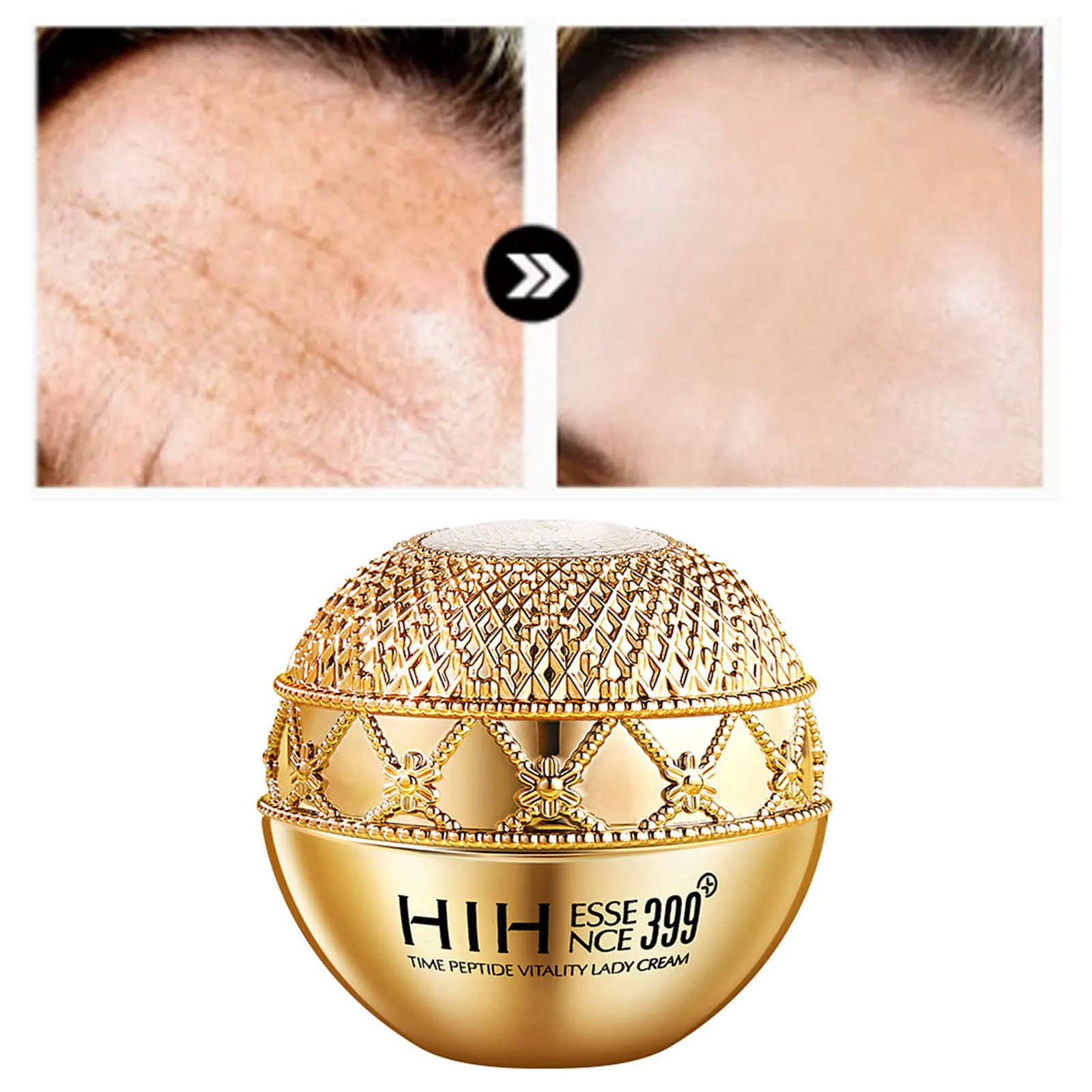 Wrinkle Reduction Cream Reduce Crow's Feet Forehead Wrinkles Eliminate ...