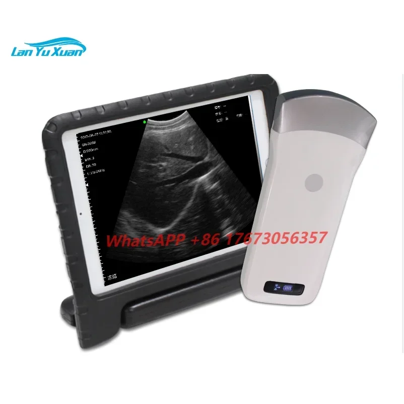 Medical-B-Type-Doppler-Ultrasound-Scanner-Wifi-Wireless-Probe-Convex ...