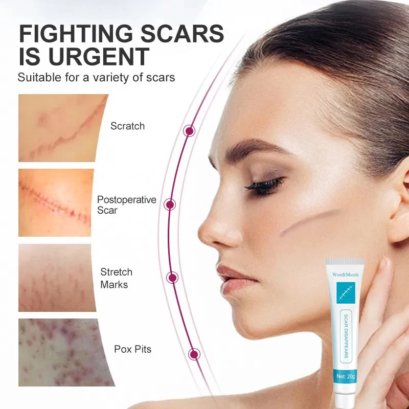 Scar-Removal-Cream-Fast-Remove-Scars-Effectively-Treat-Skin-Surgery ...