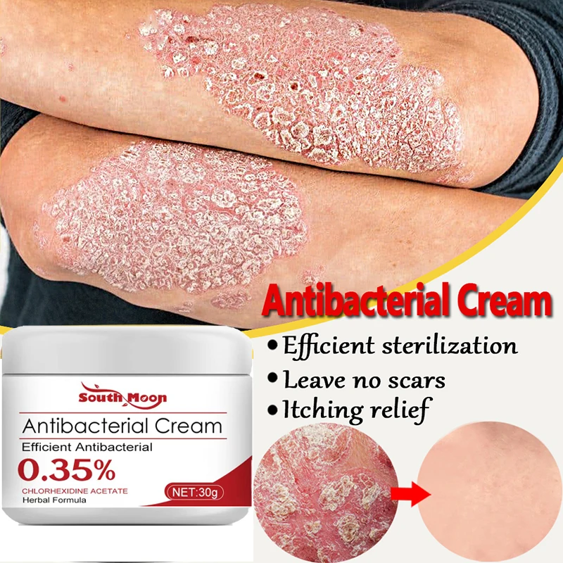 Psoriasis-Moisturizing-Cream-Natural-Repair-Antibacterial-Relieve ...