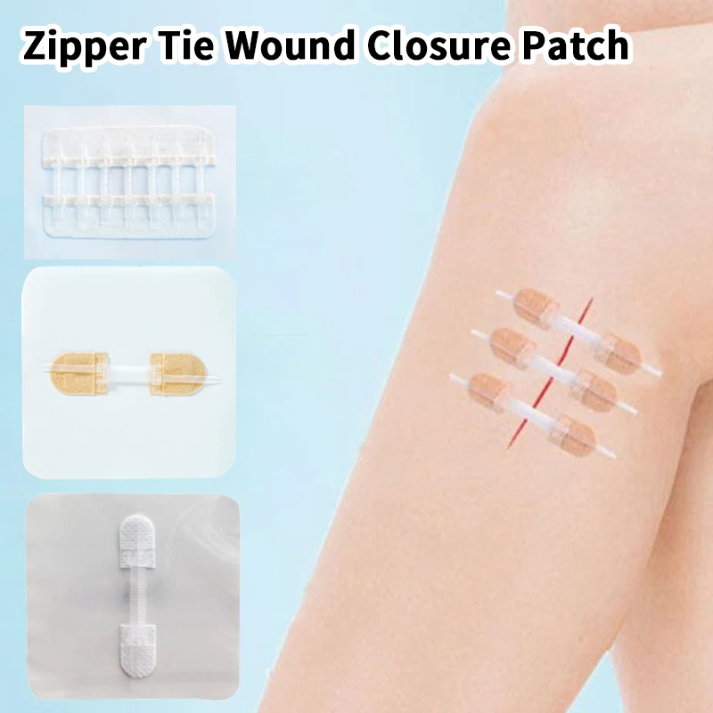 Zipper Tie Wound Closure Patch Hemostatic Patch Wound Fast Suture ...