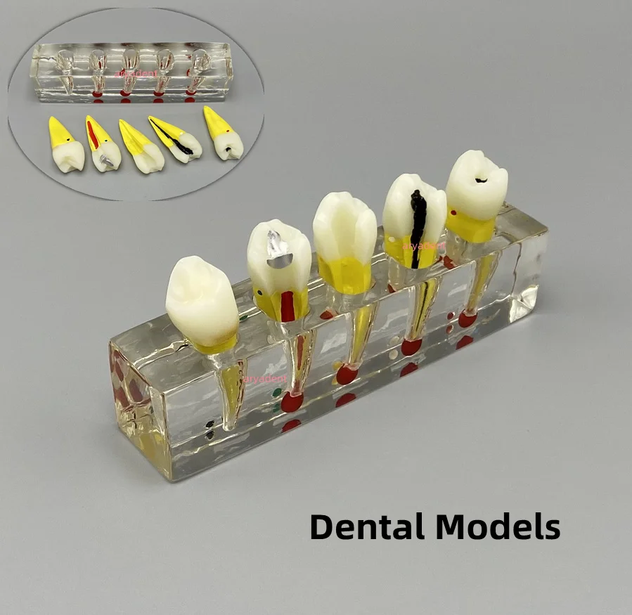 Dental-Models-Root-Canal-Treatment-Therapy-Model-Removable-Crown ...