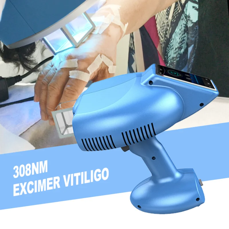 Excimer-l-ser-de-308nm-para-tratamiento-eficaz-de-la-piel-l-mpara-de ...