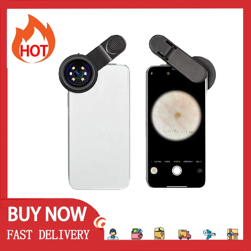 Mobile-Phone-Dermatoscope-Self-diagnostics-Polarized-Light-Skin ...