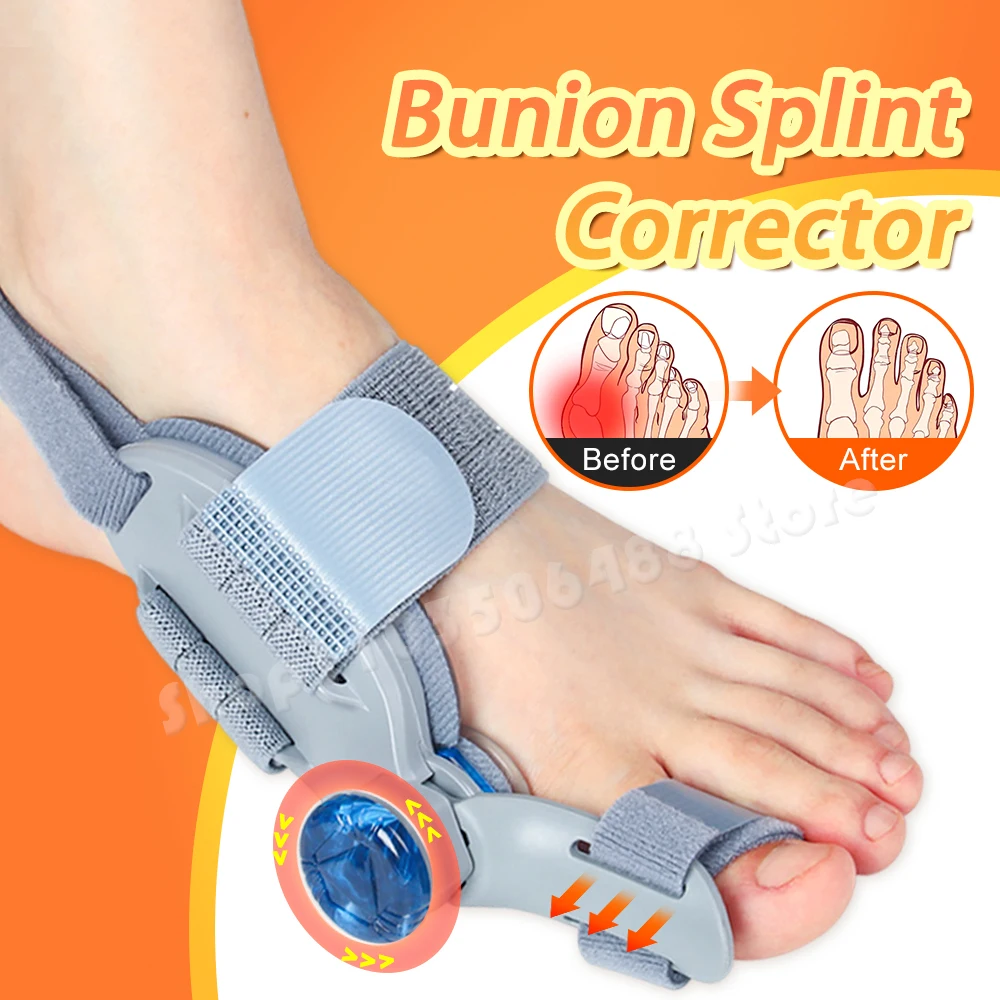 Hallux-Valgus-Bunion-Splint-Corrector-for-Women-Men-Big-Toe-Orthopedic-Toe-Straightener-Left ...