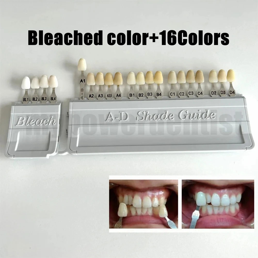 Dental-Teeth-Shade-Guide-Porcelain-20Color-A-D-Tooth-4-Bleach.jpg