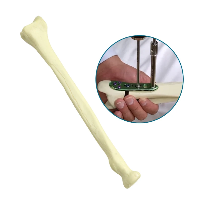 Human-Skeleton-Model-Radius-Practice-Drilling-Model-Medical-Teaching ...