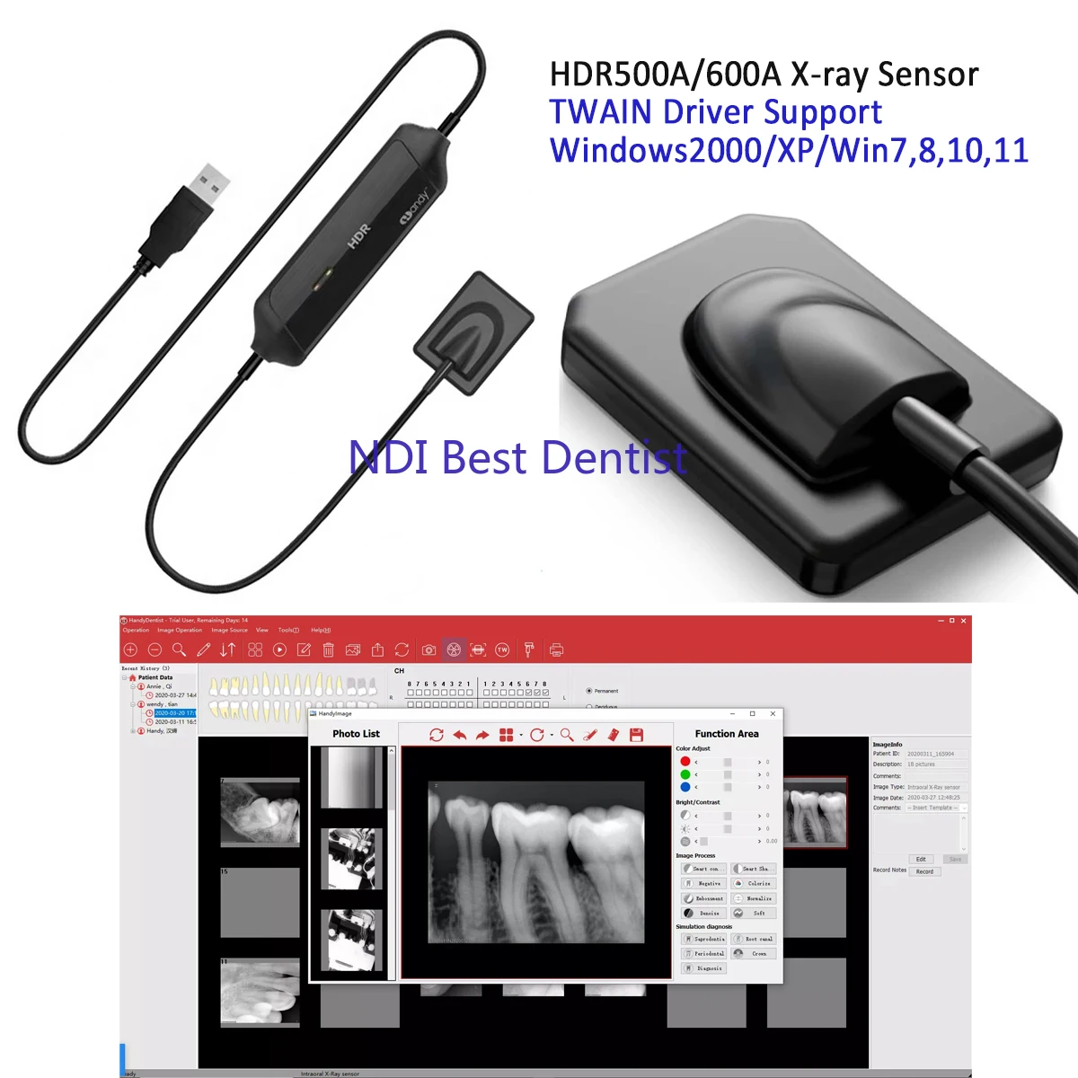 Sistema-de-imagem-port-til-de-raio-X-dental-HDR-Tooth-HDR-RVG-HDR-500B ...