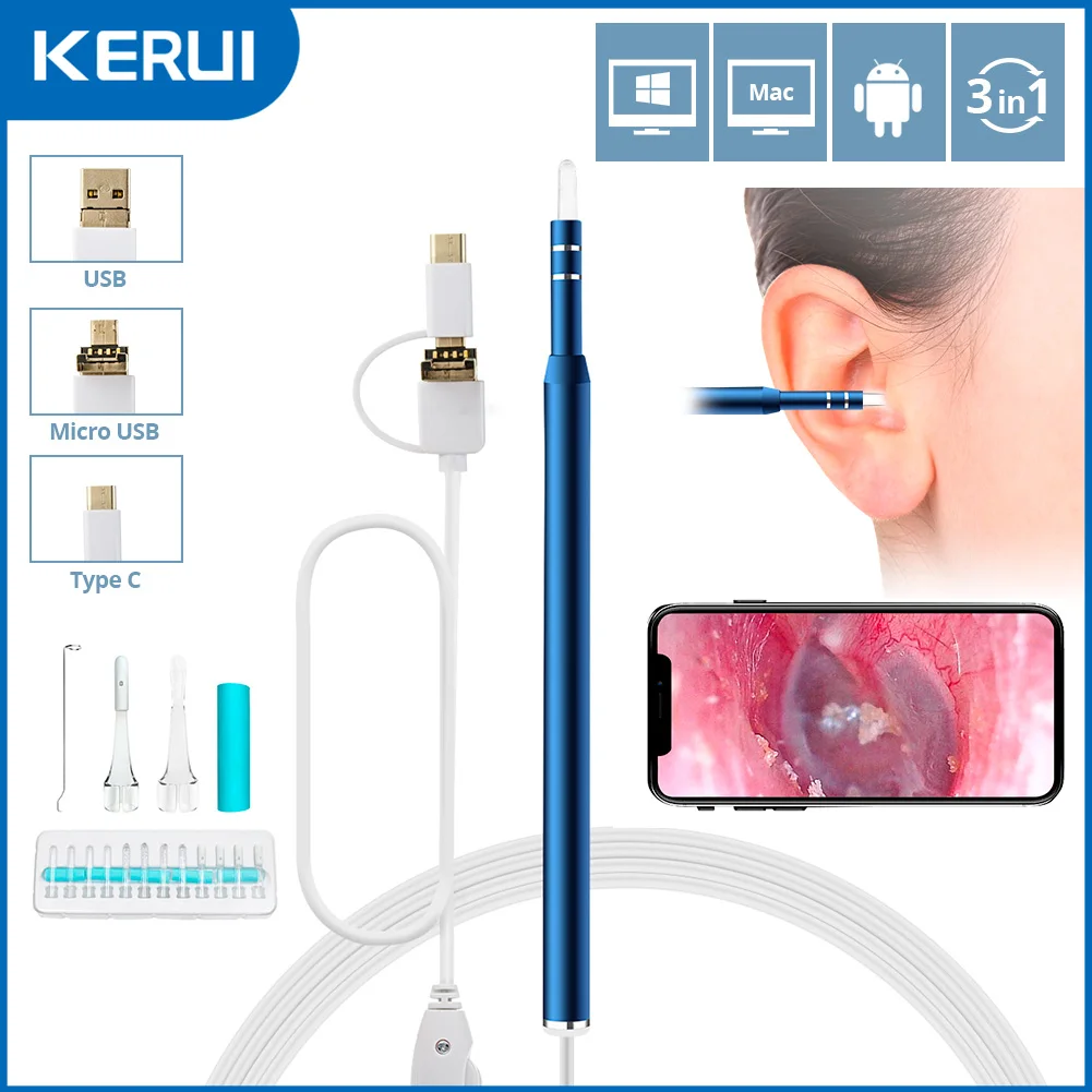 KERUI-480P-Camera-Ear-Pick-3-in-1-USB-OTG-Visual-Ear-Cleaning-Endoscope ...