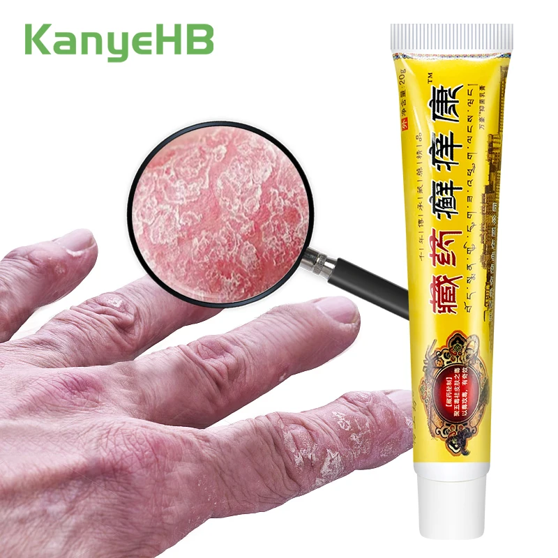 1Pcs Psoriasis Cream Removal Eczema Best Against Skin Fungal Infection ...