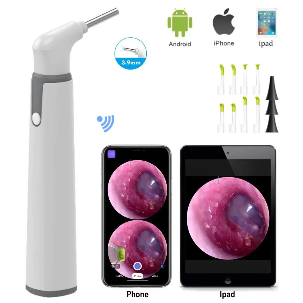 3.9mm WIFI Visual Digital Otoscope Ear Endoscope Camera Medical Ear Wax ...