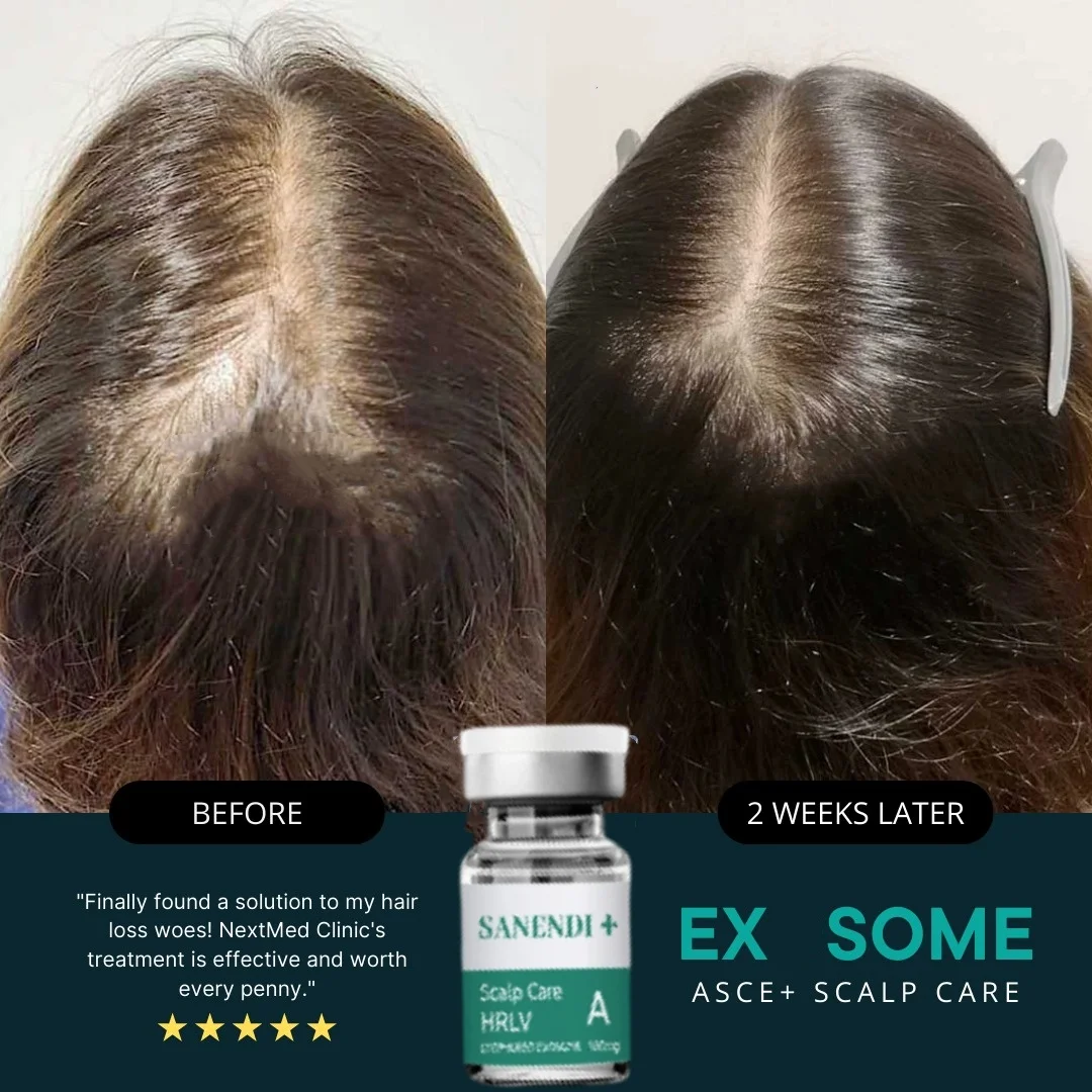 Exobio Meso Suero para un crecimiento rápido del cabello Kit ...