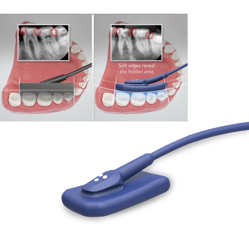 Newest-Vatech-High-Pixel-Portable-Den-tal-Intraoral-X-Ray-RVG-Sensor.jpg