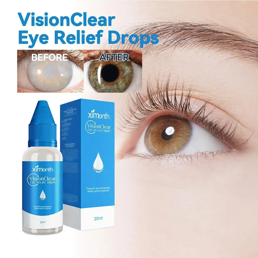 20ml-Cataract-Eye-Treatment-Medicine-For-Black-Shadow-Cloudy-Eyeball ...