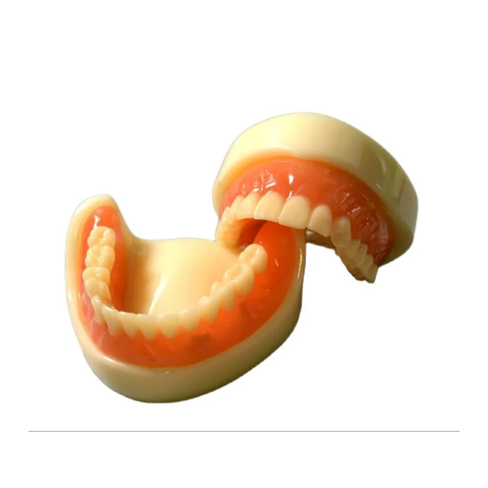 Dental-Full-Denture-Model-Overdenture-Magnetic-Attachment-Mandibular ...