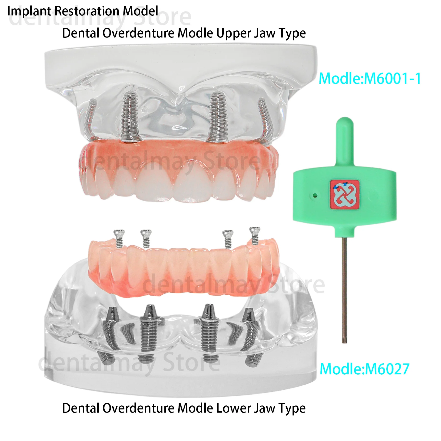 Dental-Implant-Teeth-Model-Transparent-Upper-Lower-Jaw-Type-All-on-4 ...
