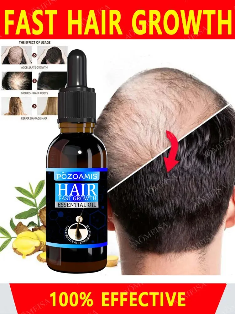Fast-Hair-Growth-Regulator-produtos-para-perda-de-cabelo-seborreica ...