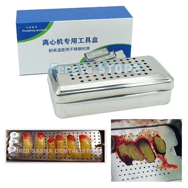 1Set Dental PRF GRF BOX Stainless Steel Implant Plate Rich Fibrin BOX ...