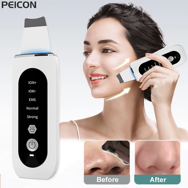 Ultraschall-Haut-w-scher-Peeling-Mitesser-Entferner-tiefe-Gesichts ...