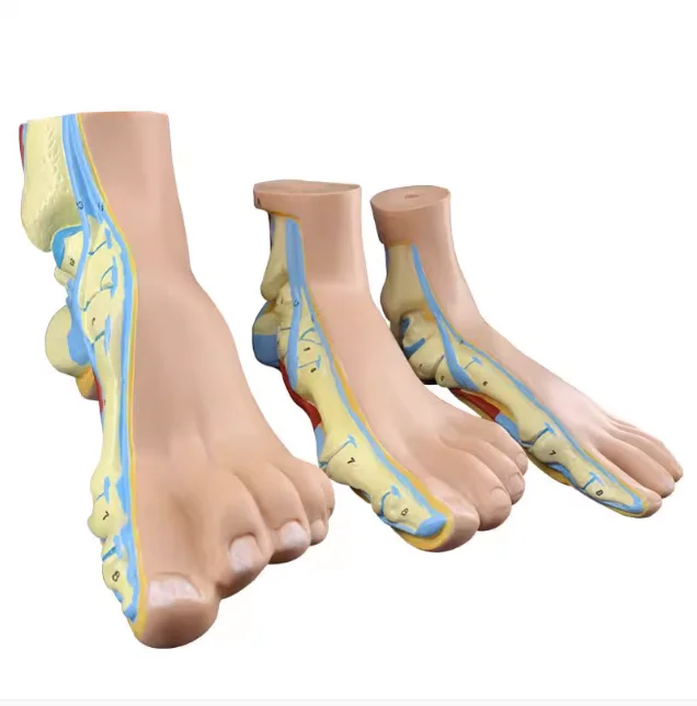 Human-Foot-Muscles-Flatfoot-Talipes-cavus-Bow-foot-model-Anatomical ...