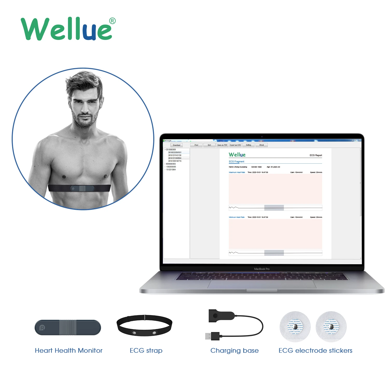 Wellue ER1 Wearable Ecg Monitor Handheld Ekg Heart Monitor, 41% OFF