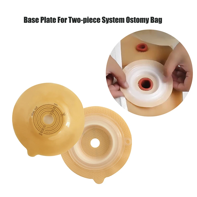 Colostomy-Bags-Baseplates-Hydrocolloid-Stoma-Care-Durable-Skin-Barriers ...